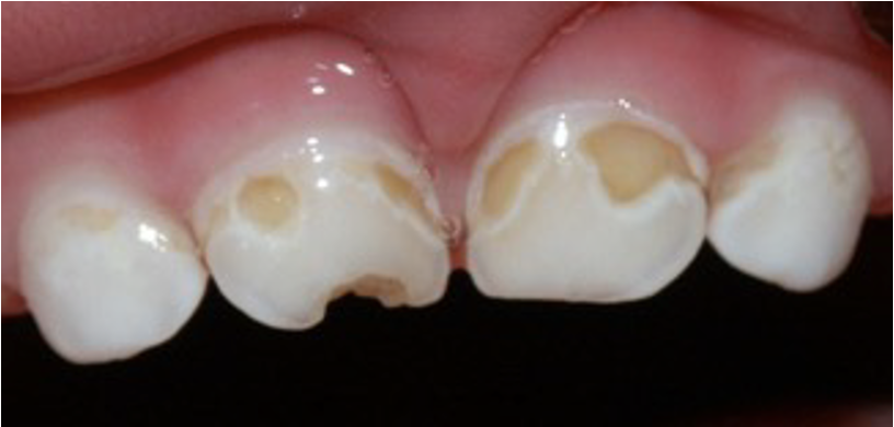 les clés pour une bonne santé dentaire – Les petites dents